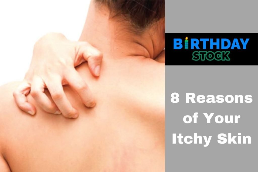8 Reasons Of Your Itchy Skin - Birthday Stock